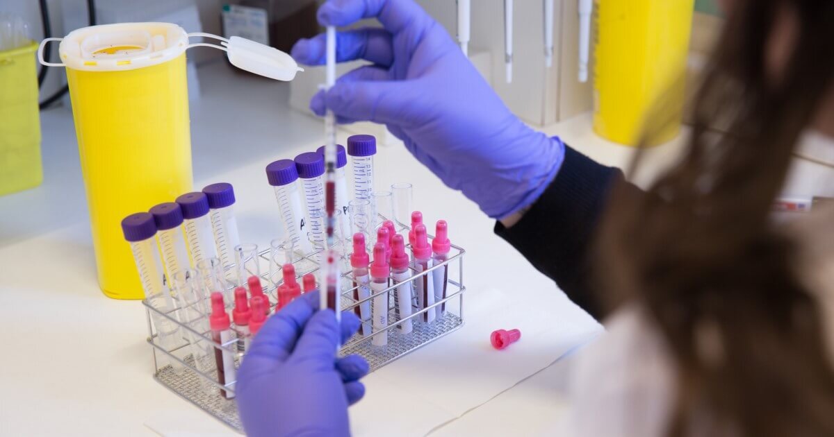 EDIT-B Consortium validating innovative blood diagnostic test for ...