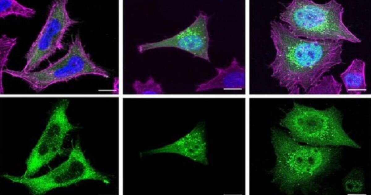Nuevos avances en la investigación de la síndrome de Schaaf-Yang ...